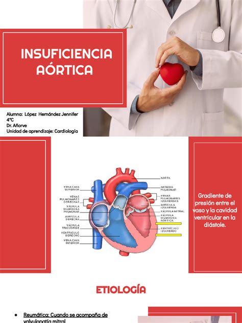 Insuficiencia Aórtica Pdf Medicina Clinica Especialidades Medicas