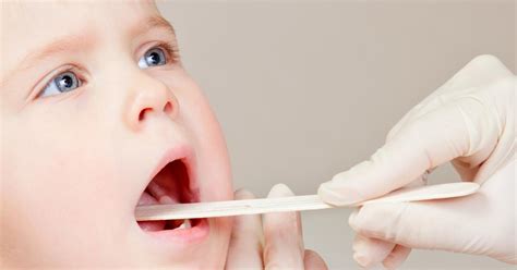 Symptoms Causes And Treatment Of Thrush In Babies Healthprep Com