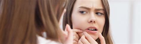 Acne Na Adolescência 7 Alimentos Que Aliviam Os Sintomas
