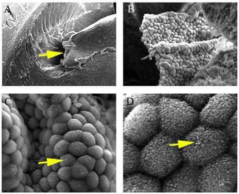 Figure 1 From The Role Of Epithelial Primary Cilium In The Development