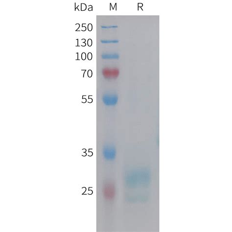 Recombinant Human Hmgb1 Protein With C Terminal 6Ã—his Tag
