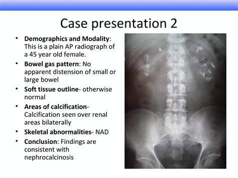Abdominal Imaging Lecture PPT