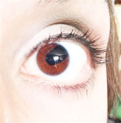 17 Best Images About Colobomas On Pinterest Daniel Oconnell The