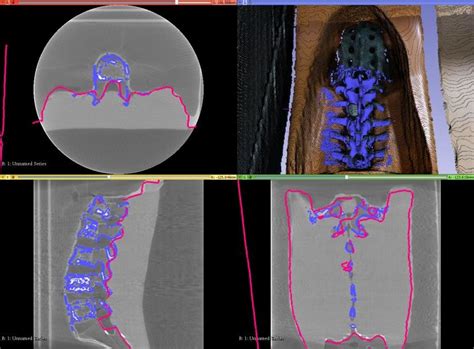Registered Cbct And Camera Image Visualization In 3d Slicer Spine Download Scientific Diagram