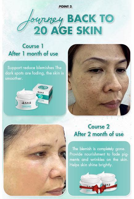 Best Seller Cream Melasma Lazada Ph