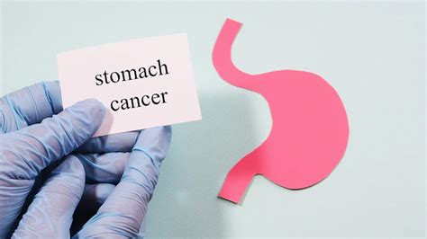 How Does Early Detection Play A Role In Stomach Cancer And Symptoms To