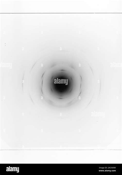 Procollagen Structure X Ray Crystallography Diffraction Pattern Obtained As Part Of Research To