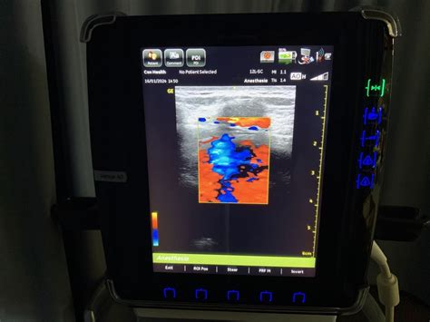 Ge 12l 12l Sc Linear Array Ultrasound Transducer Probe For Venue 40
