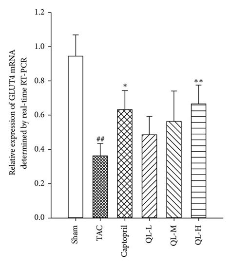 Real Time Reverse Transcription Rt Pcr Results A The Expression Of