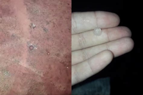 Chuva De Granizo E Ventania Destelham Casas E Danificam Galpões No