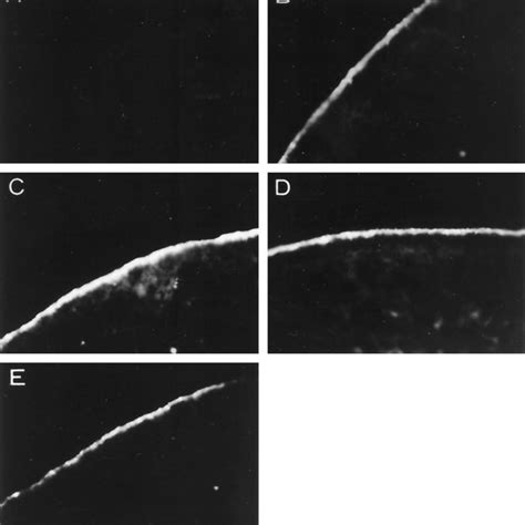 Immunocytochemistry Of Oocytes Injected With Crna Encoding Wild Type Download Scientific