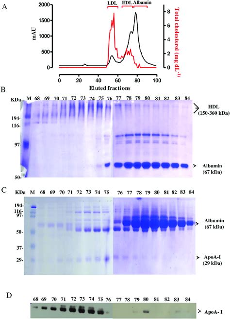 Isolation Of Enriched Hdl Fractions A Plasma Protein Distribution On