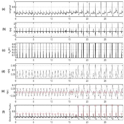 Figure 4 From A Simple And Robust Qrs Detection Algorithm For Wireless Medical Body Area Network