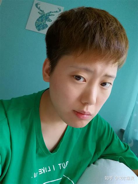 埋线双眼皮 记录贴 知乎