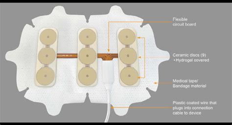 The Novottf 100a System Transducer Array Download Scientific Diagram