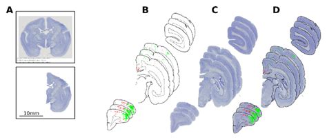 Preprocessing Of The Nissl Sections And Plotting Software Data A Download Scientific Diagram