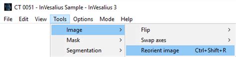 User Manual InVesalius3 2023 07 03 Documentation