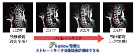 院長コラム『ストレートネック（スマホ首）』｜京都木原病院