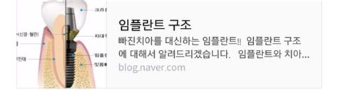 임플란트 기성어버트먼트 Vs 커스텀어버트먼트 네이버 블로그