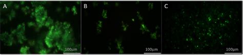 Fluorescence Microscopy Results Revealing Amyloid Fibril Deposits By Download Scientific