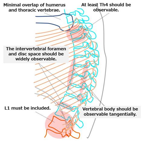 Thoracic Spine Lateral ViewTools For RadTech