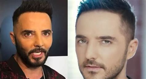 Gökhan Özen Estetik Yaptırdı Son Halini Görenler İnanamadı Özgün Kocaeli
