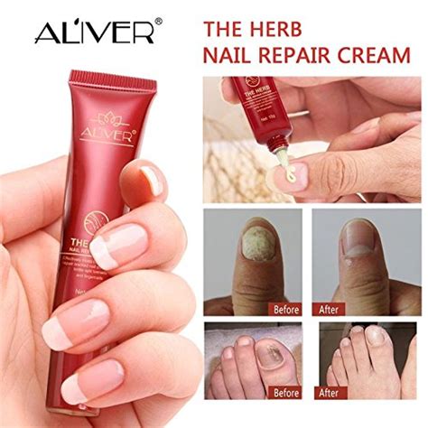 Comprar Crema Para Los Hongos De Los Pies Desde 2 25 Estarguapas