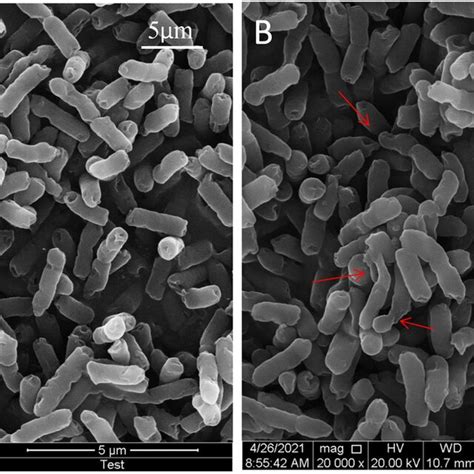Scanning Electron Microscopy Image Of E Coli W3110 Cells Magnified