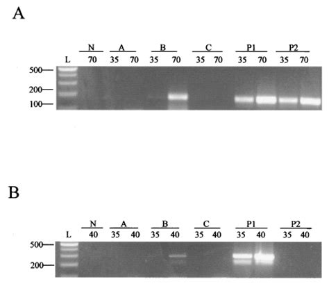 Agarose Gel Electrophoresis Of B Anthracis Genes Ampli Fi Ed By Pcr
