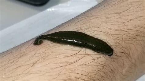 How Do Leeches Grow At Jenenge Blog