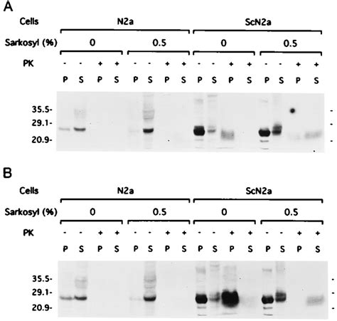 After Solubilization In Sarkosyl And Ultracentrifugation Prp Sc 106 Download Scientific