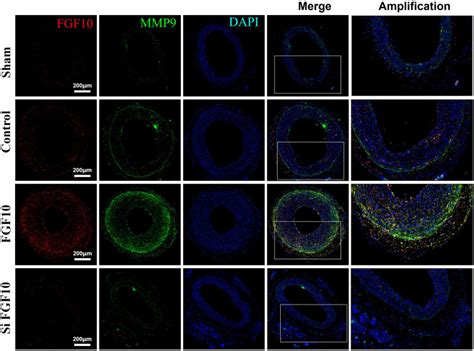 Vascular Adventitial Fibroblasts Derived Fgf10 Promotes Vascular Smooth Muscle Cells