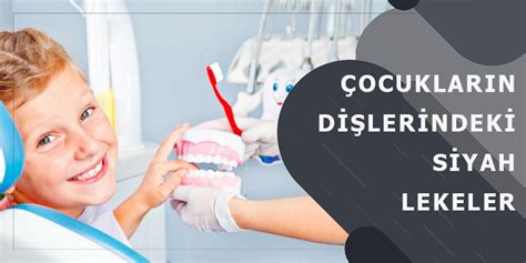 Çocukların Dişlerindeki Siyah Lekeler Neden Olur