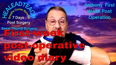 Basal Thumb Operation At Lois Toussaint Blog