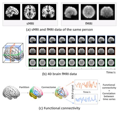 220803028 Multimodal Brain Disease Classification With Functional