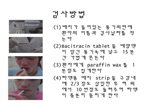 Snyder Testandalban Testands Mutans Screeningand타액분비능검사 Ppt