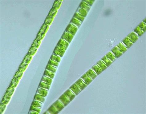 Protist Images Ulothrix