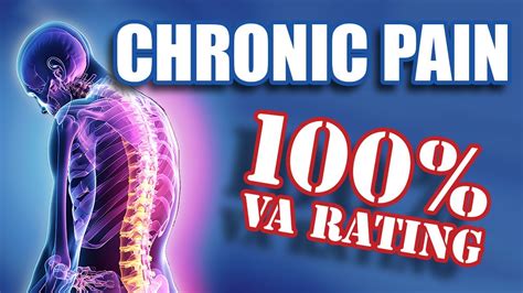 How To Get A VA Rating For Chronic Pain YouTube