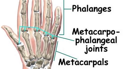 Metacarpophalangeal Joint Extension The Stiff Hand And The Spastic