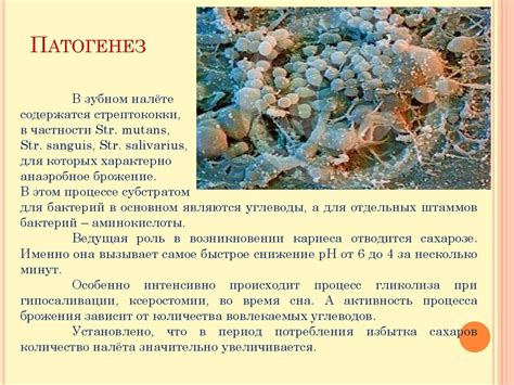 Этиология патогенез диагностика кариеса зубов презентация онлайн