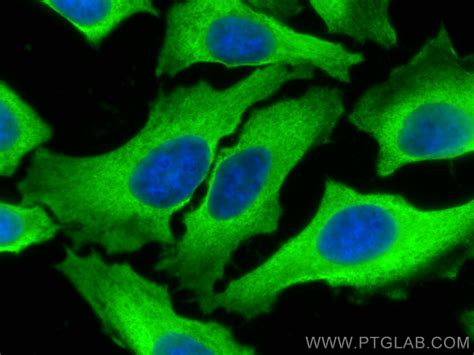 ENO1 Antibody 11204 1 AP Proteintech