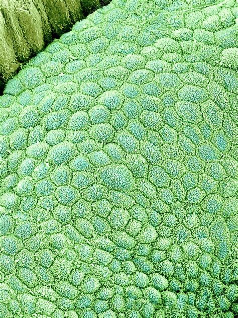 Gallbladder Surface Sem Stock Image C015 9613 Science Photo Library