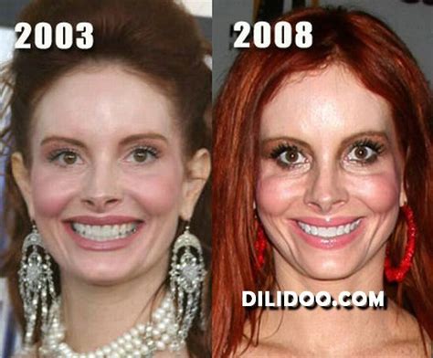 17 Of The Worst Plastic Surgery FAILS Do They See What We See