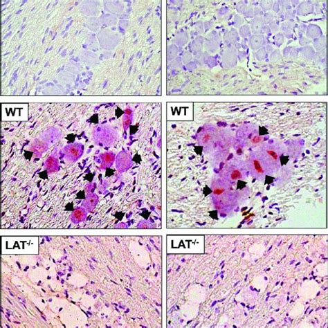 β Catenin Expression Is Increased In Latently Infected Tg Tg Were Download Scientific Diagram