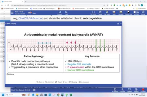 Cardio Rate Rhythm Tachy General 1 A Flutter Fibrill Supraventricular Tachy V Tachy V