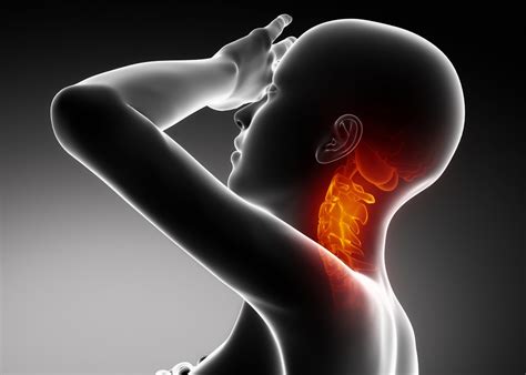 Cervicale Infiammata Sintomi F Medical Group