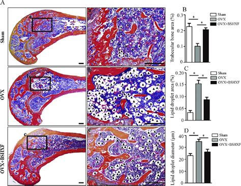 Bshxf Protects Against Bone Loss In Ovx Mice A Alcian Blue