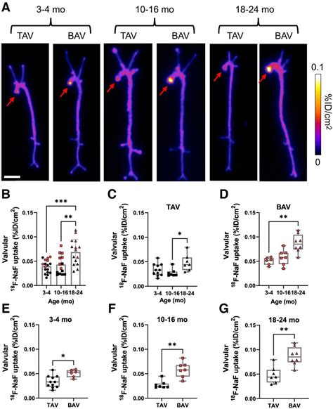 Multimodality Imaging Of Aortic Valve Calcification And Function In A Murine Model Of Calcific