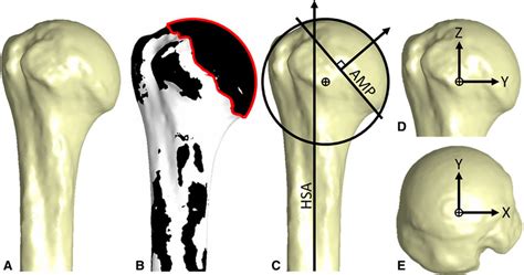 A Anteroposterior Ap View Of A Right Proximal Humerus B Plot Of Download Scientific