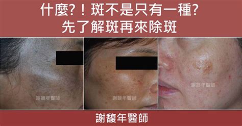 我有脂肪肝，到底要不要緊？ 照護線上 值得信賴的醫療媒體